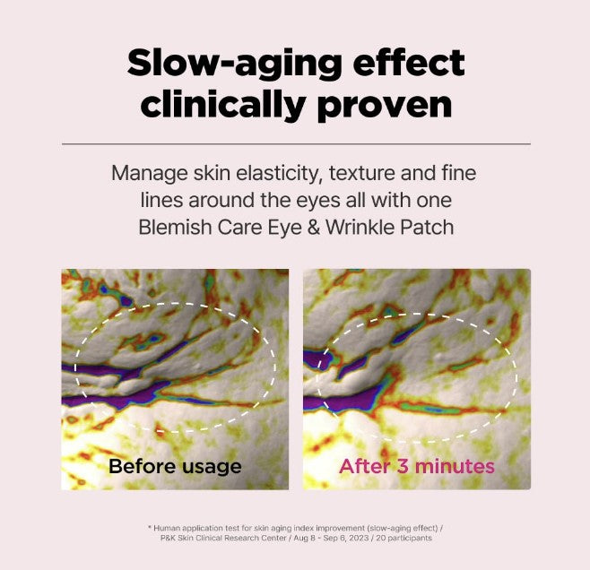 ISOI Blemish Care Eye & Wrinkle Patch 90g / 90pcs – NATURE HUB